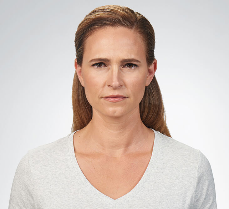 Botox in Livermore | Wrinkle Reduction at Sculpt MD