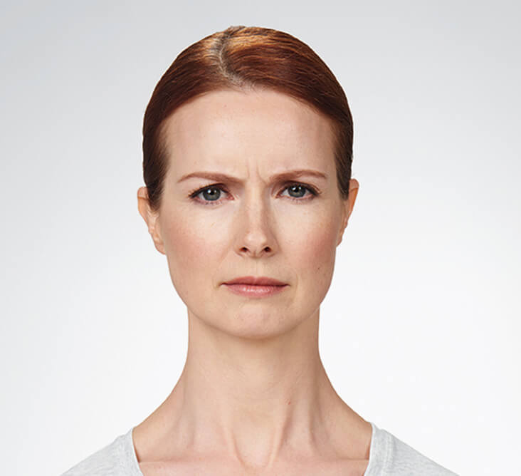 Botox in Livermore | Wrinkle Reduction at Sculpt MD