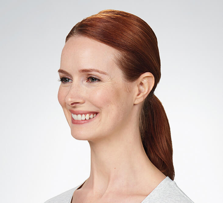 Botox in Livermore | Wrinkle Reduction at Sculpt MD