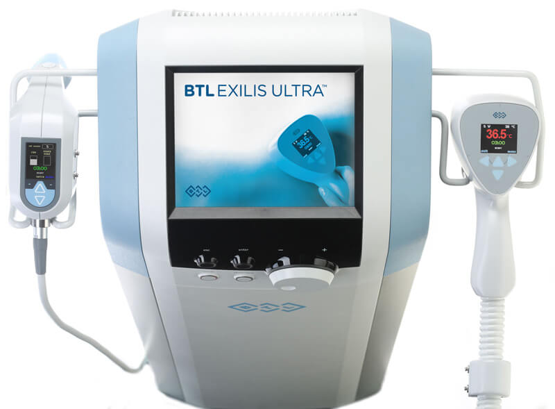 Skin Tightening in Livermore | Non-Invasive BTL Exilis at Sculpt MD