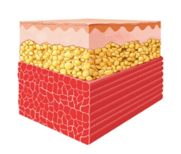 EMSCULPT in Livermore | Build Muscle & Burn Fat at Sculpt MD