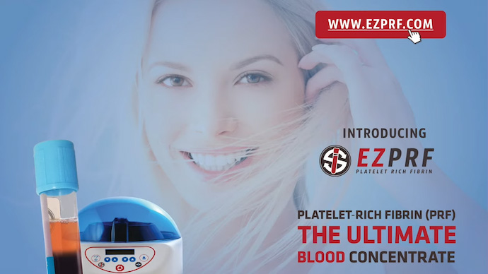 Microneedling with PRF in Livermore | Transform Your Skin | Sculpt MD