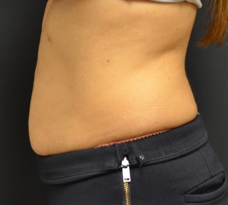 Abdomen - Sculpt MD